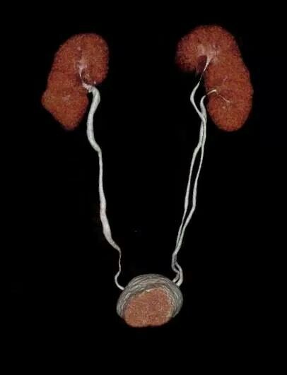 El problema de la Dosis en la URO TC – Radiología Club
