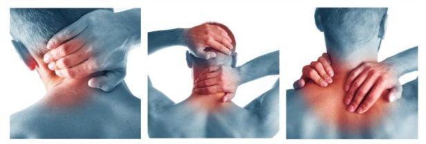 Latigazo Cervical: Anatomía y hallazgos en Radiodiagnóstico ...